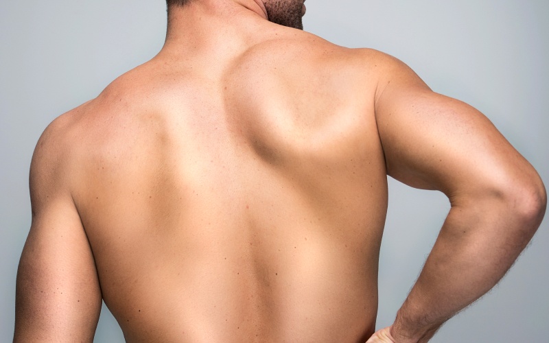 Épilation laser chez l’homme: particularités des jambes, maillot et SIF ...